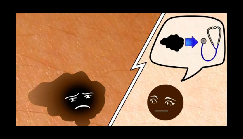 Notícias de um melanoma - Ciência HojeCiência Hoje